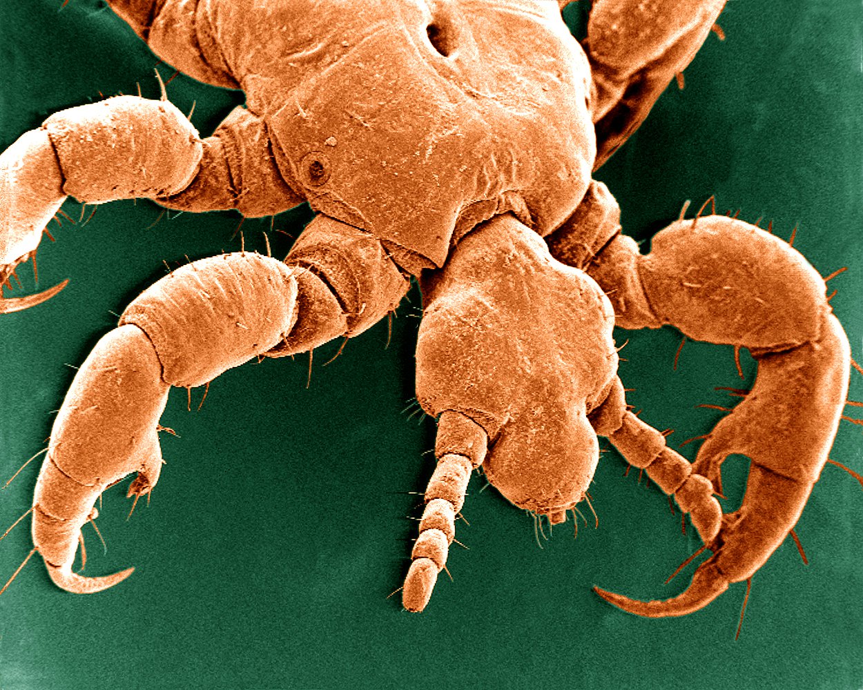 Scanning Electron Microscope - Jim Zuckerman photography & photo tours