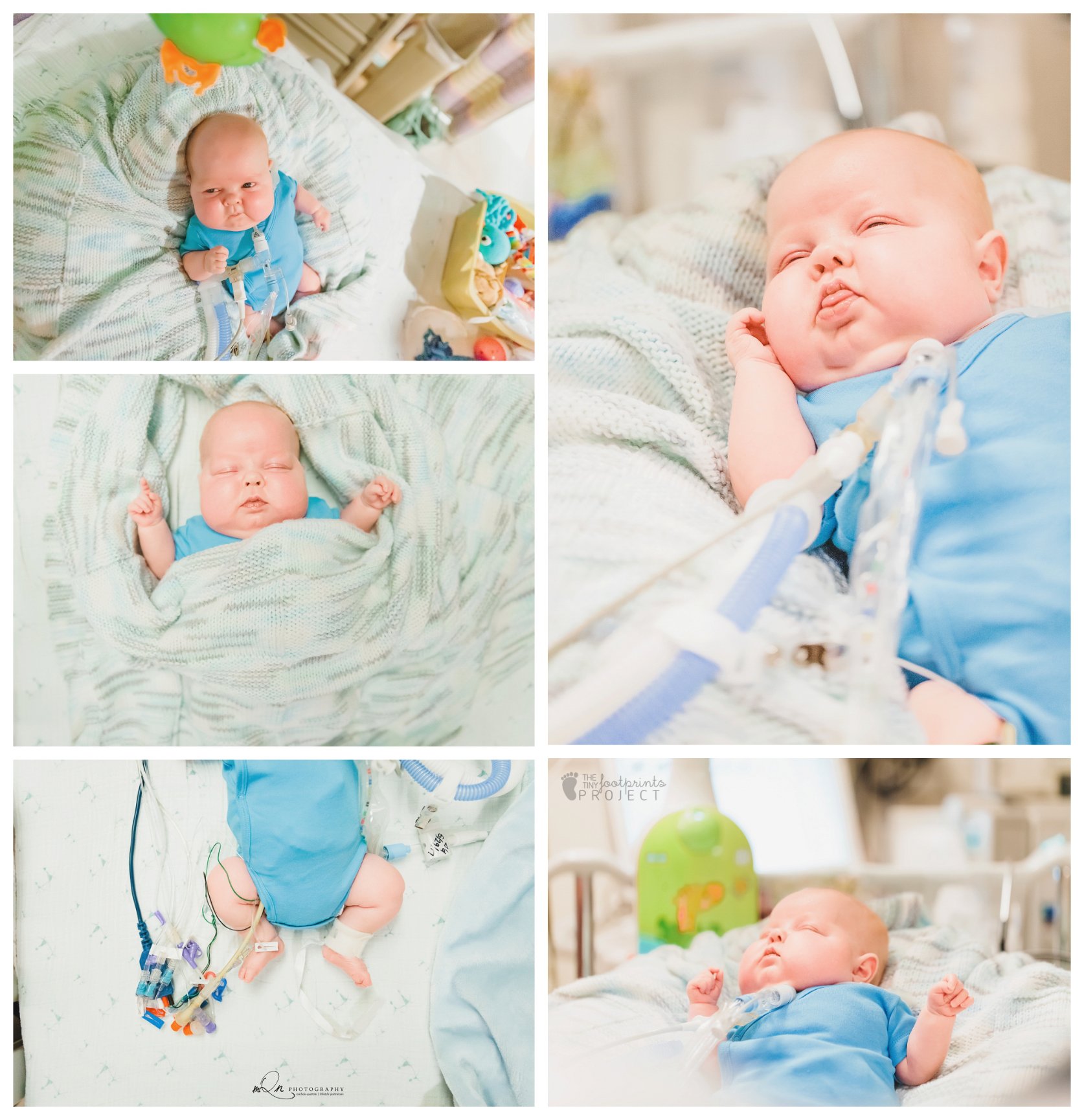 NICU Photography in the Minneapolis Area